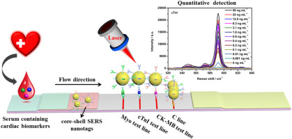 Quantitative and ultrasensitive detection of multiplex cardiac ...