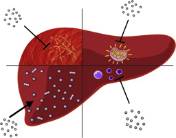 肝病的细胞外囊泡疗法,Journal of Controlled Release - X-MOL