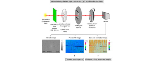 Structure and collagen crimp patterns of functionally distinct equine ...