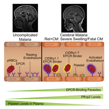Linking EPCR-Binding PfEMP1 to Brain Swelling in Pediatric Cerebral ...