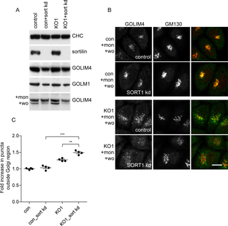 Role of the AP-5 adaptor protein complex in late endosome-to-Golgi ...