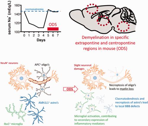 Regional oligodendrocytopathy and astrocytopathy precede myelin loss ...