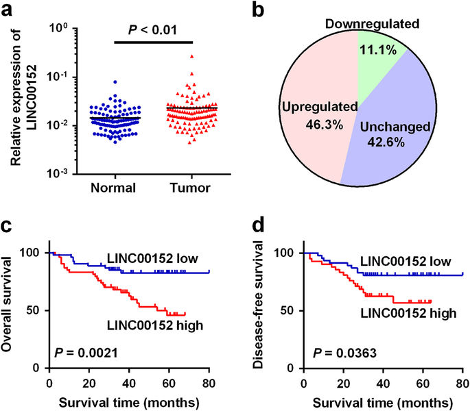 长链非编码RNA LINC00152通过抑制miR-139-5p促进结直肠癌的细胞增殖，转移并赋予5-FU耐药性。,Oncogenesis ...