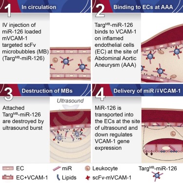 miRs的双靶点治疗学递送阻滞了腹主动脉瘤的发展。,Molecular Therapy - X-MOL
