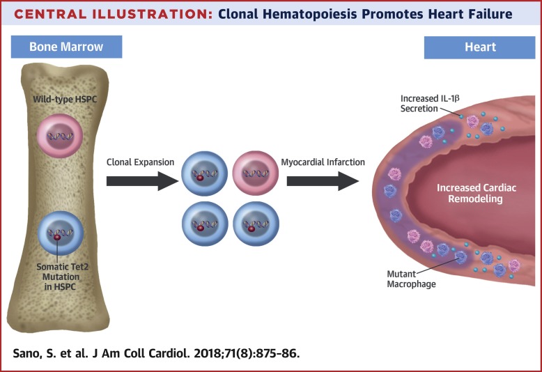 Tet2 介导的克隆造血通过涉及 IL-1β/NLRP3 炎性体的机制加速心力衰竭,Journal of the American ...