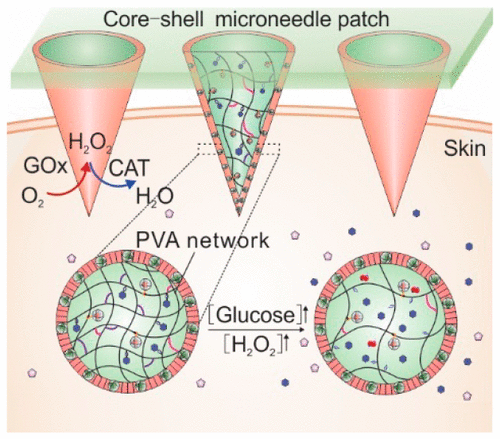 Core–Shell Microneedle Gel for Self-Regulated Insulin Delivery,ACS Nano ...