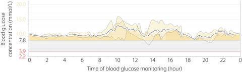 Application of 3C insulin pump system in combination with non‐invasive ...