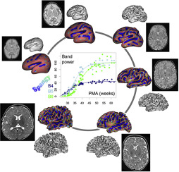 The dynamics of cortical folding waves and prematurity-related ...