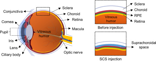 The suprachoroidal space as a route of administration to the posterior ...