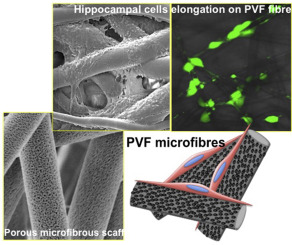 Development of a novel porous polyvinyl formal (PVF) microfibrous ...