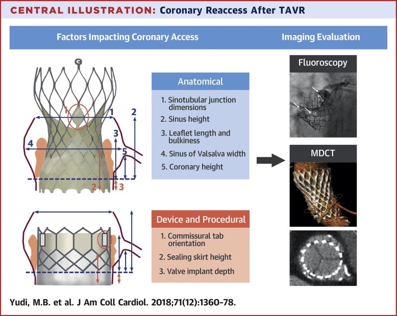 Coronary Angiography and Percutaneous Coronary Intervention After ...