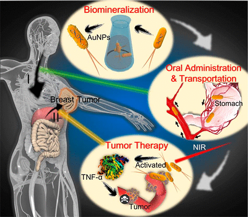 Bacteria-Mediated Tumor Therapy Utilizing Photothermally-Controlled TNF ...