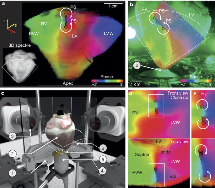 Electromechanical vortex filaments during cardiac fibrillation,Nature ...