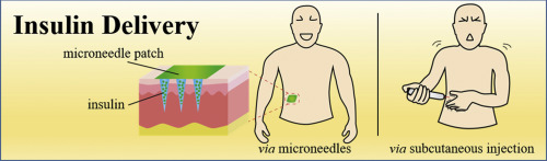 Insulin delivery systems combined with microneedle technology,Advanced ...