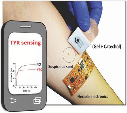 Wearable Wireless Tyrosinase Bandage and Microneedle Sensors: Toward ...