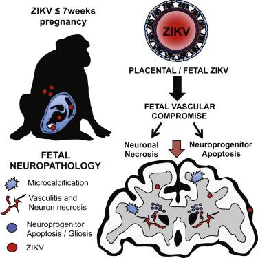 Fetal Neuropathology in Zika Virus-Infected Pregnant Female Rhesus ...