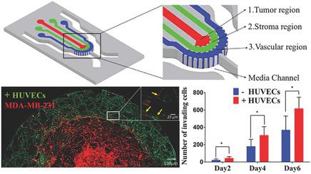 Microfluidic Tumor–Vascular Model to Study Breast Cancer Cell Invasion ...