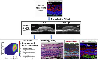 Sheets of human retinal progenitor transplants improve vision in rats ...