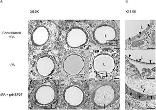 磷酸化的重组HSP27在接受静脉内组织纤溶酶原激活剂的小鼠中风后可保护大脑并减轻血脑屏障破坏,PLOS ONE - X-MOL