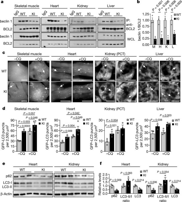 Disruption of the beclin 1–BCL2 autophagy regulatory complex promotes ...