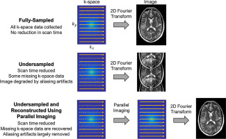 Recent advances in parallel imaging for MRI,Progress in Nuclear Magnetic Resonance Spectroscopy ...
