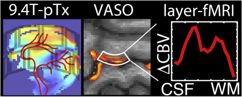Ultra-high resolution blood volume fMRI and BOLD fMRI in humans at 9.4 ...