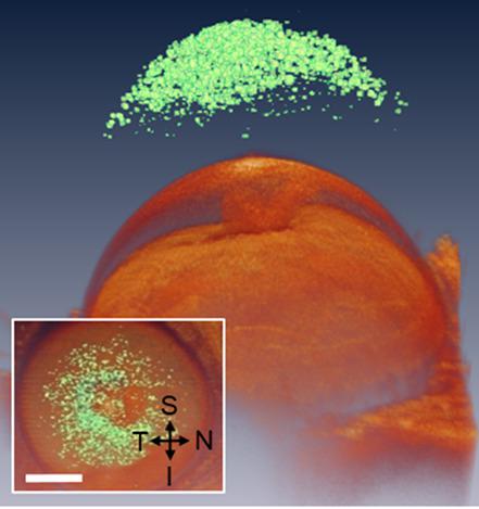 Automated three‐dimensional cell counting method for grading uveitis of ...