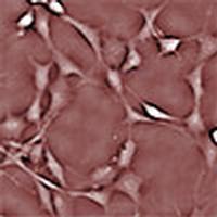 Quantitative differential phase contrast imaging at high resolution ...