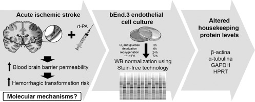 Evaluation of common housekeeping proteins under ischemic conditions ...