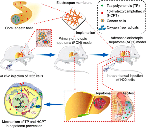 Locally Deployable Nanofiber Patch for Sequential Drug Delivery in ...
