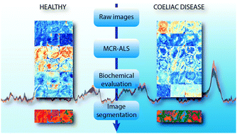 Potential use of MCR-ALS for the identification of coeliac-related biochemical changes in ...