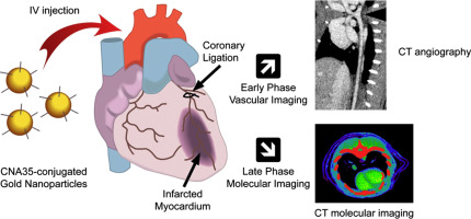 CNA35偶联金纳米颗粒对心肌瘢痕负荷的CT成像,Nanomedicine: Nanotechnology, Biology and ...