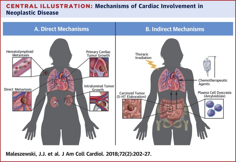 肿瘤和心脏,Journal of the American College of Cardiology - X-MOL