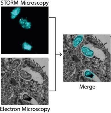Ultrastructural Imaging of Salmonella–Host Interactions Using Super ...