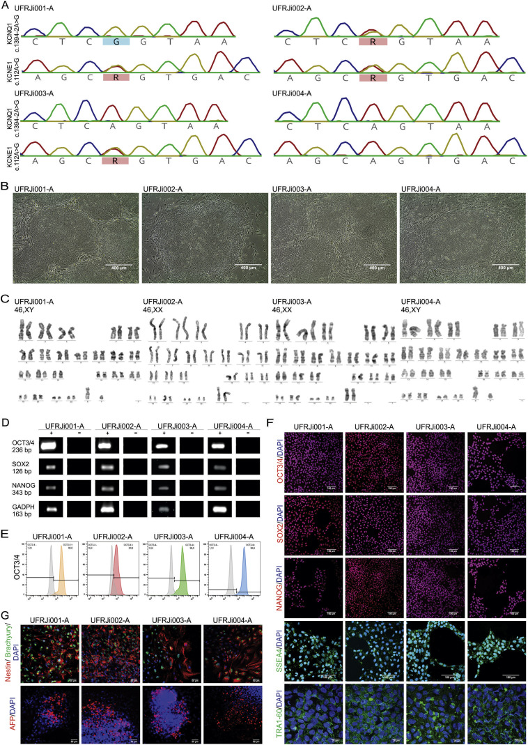Generation of patient-specific induced pluripotent stem cell lines from ...