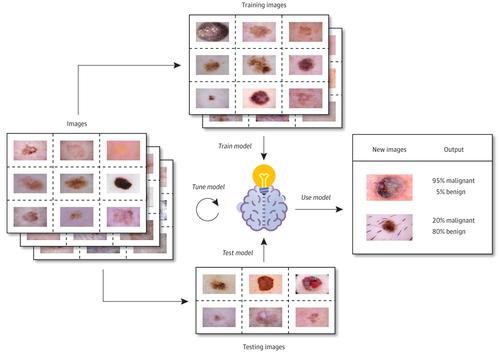 Machine Learning and Health Care Disparities in Dermatology,JAMA ...