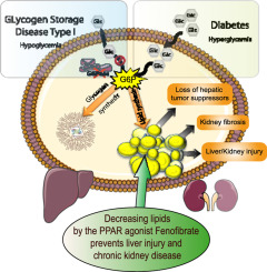Intracellular lipids are an independent cause of liver injury and ...
