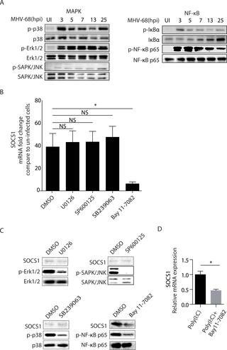 巨噬细胞中 IFN-γ 对鼠疱疹病毒 68 复制的抑制可通过诱导 SOCS1 表达来抵消,PLoS Pathogens - X-MOL