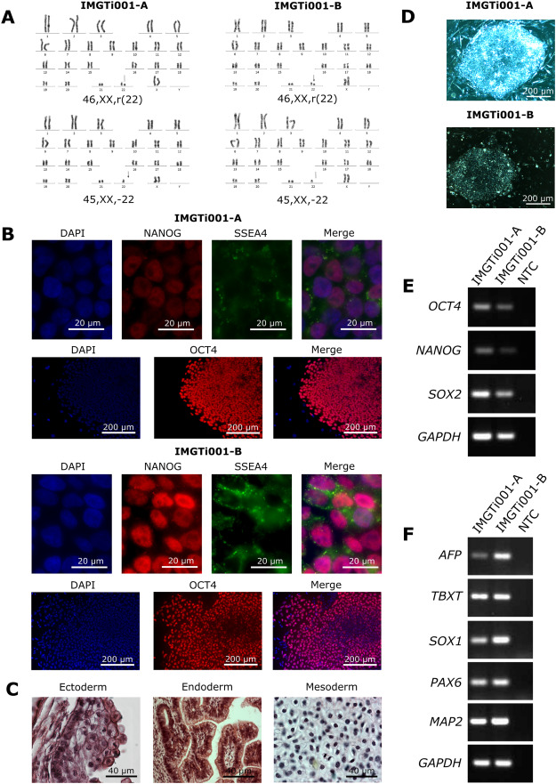 Generation of two iPSC lines (IMGTi001-A and IMGTi001-B) from human ...