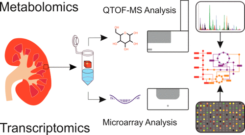 Simultaneous Extraction of RNA and Metabolites from Single Kidney ...
