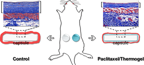 Thermogel Loaded with Low-Dose Paclitaxel as a Facile Coating to ...