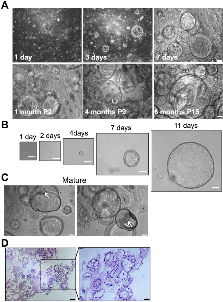 Long-term organoid culture reveals enrichment of organoid-forming ...