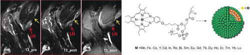 Nanotexaphyrin: One‐Pot Synthesis of a Manganese Texaphyrin ...