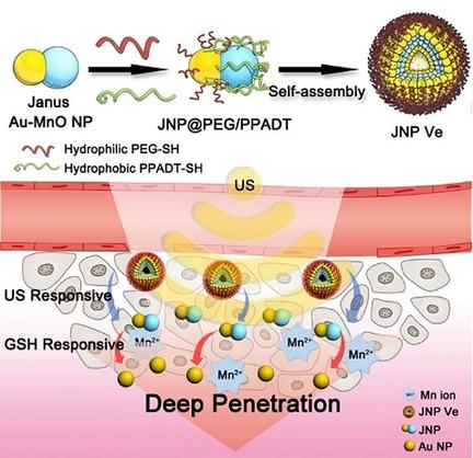 An Ultrasound Activated Vesicle of Janus Au-MnO Nanoparticles for Promoted Tumor Penetration and ...