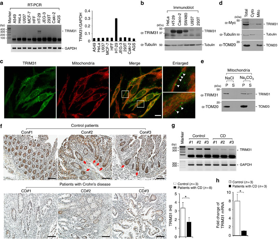 TRIM31 promotes Atg5/Atg7-independent autophagy in intestinal cells ...