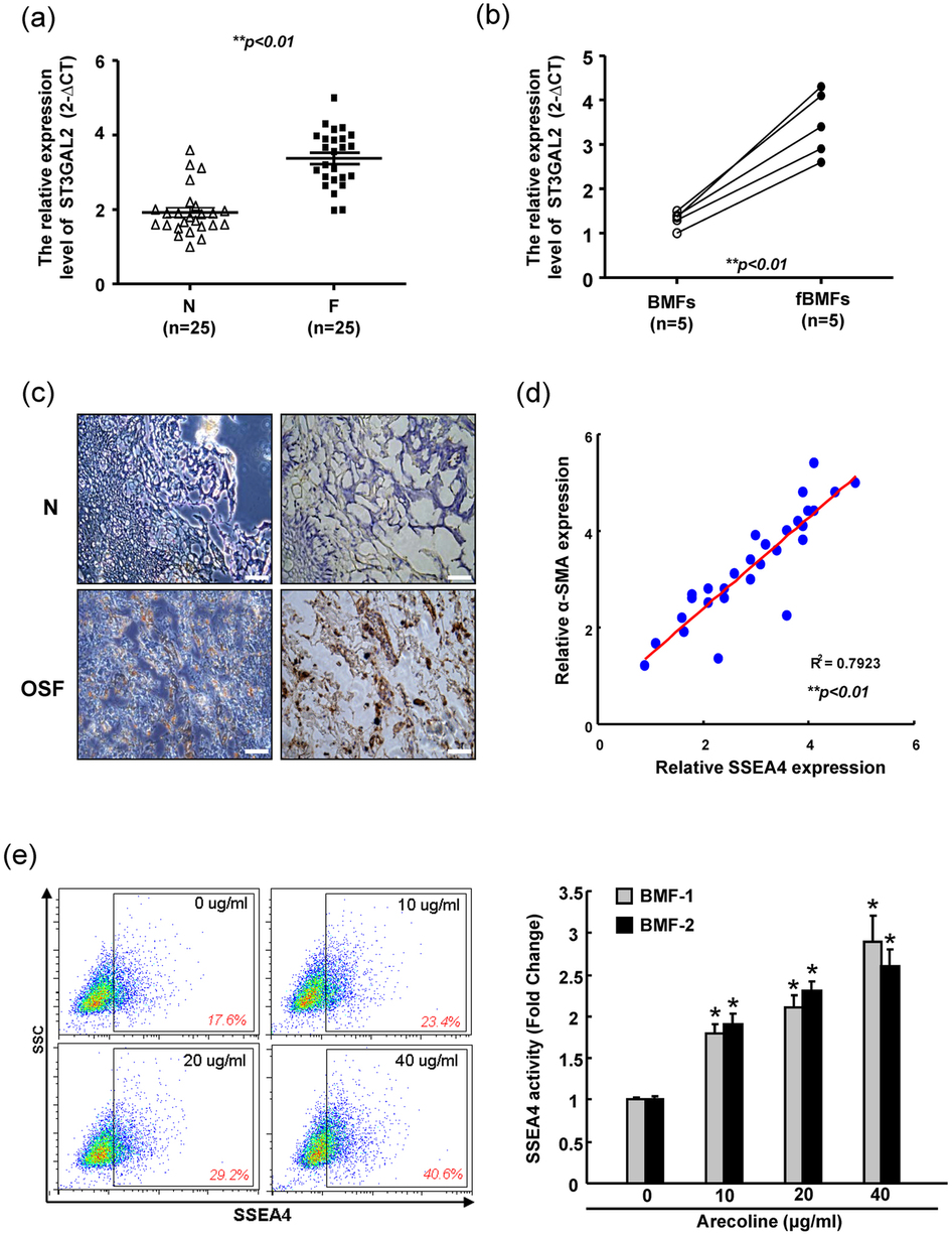 Aberrant SSEA-4 upregulation mediates myofibroblast activity to promote ...