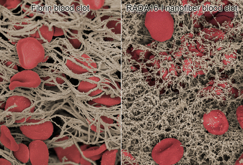 Clotting Mimicry from Robust Hemostatic Bandages Based on Self ...