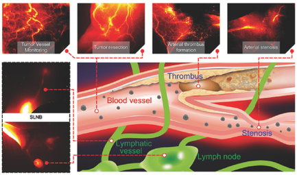 Multifunctional Biomedical Imaging in Physiological and Pathological ...