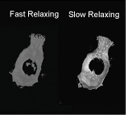 基质应力松弛可调节体内的支架重塑和骨形成。,Advanced Healthcare Materials - X-MOL