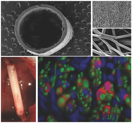 PEOT / PBT指南可增强长间隙缺损的神经再生,Advanced Healthcare Materials - X-MOL